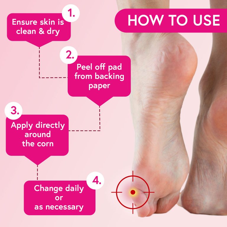 Corn Pads Oval | Carnation Footcare Australia